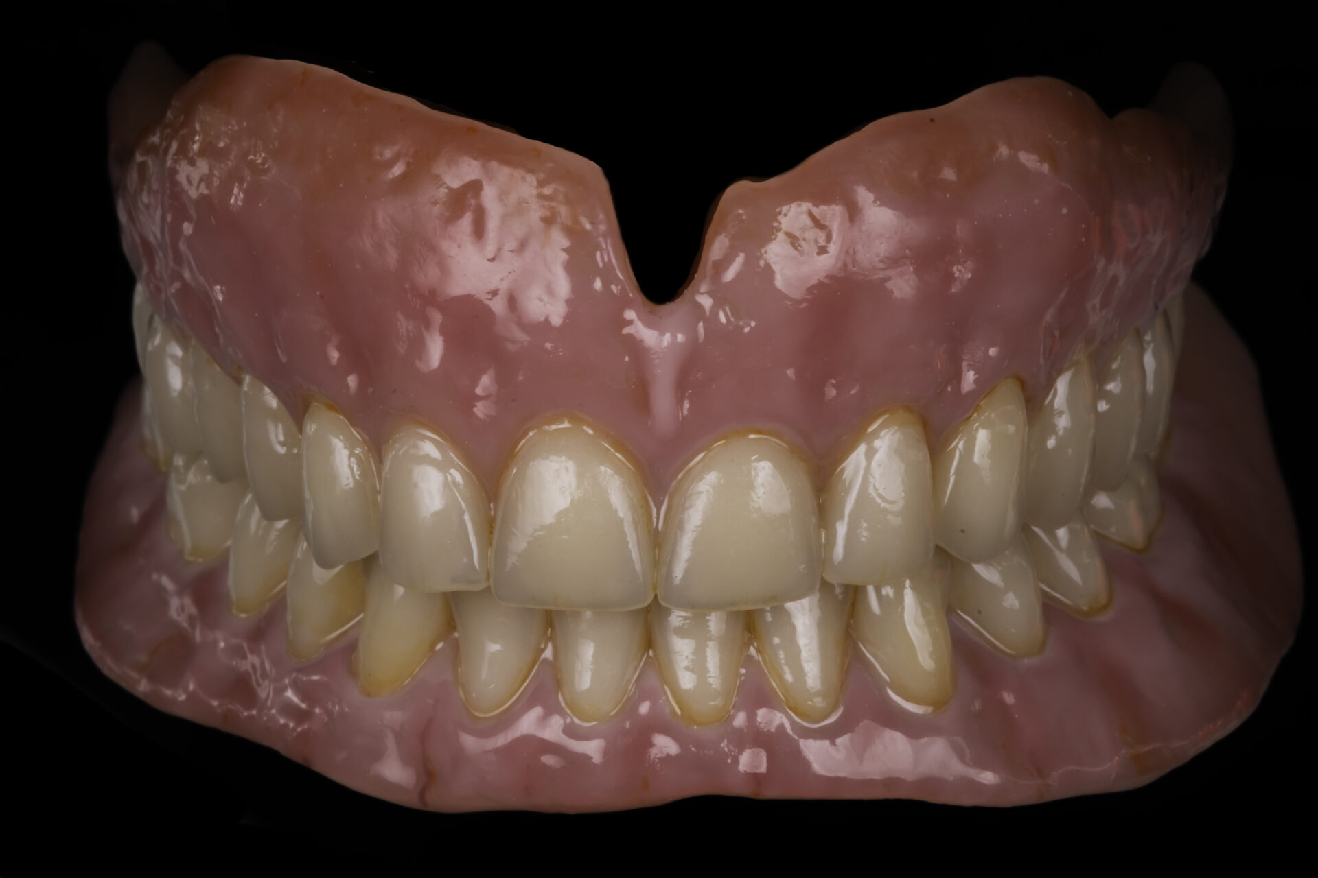 Prótesis fija y removible - ATA-ALI DENTAL CLINIC